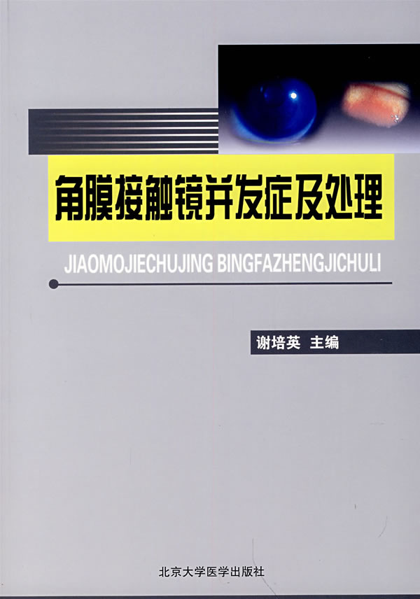 角膜接触镜并发症及处理