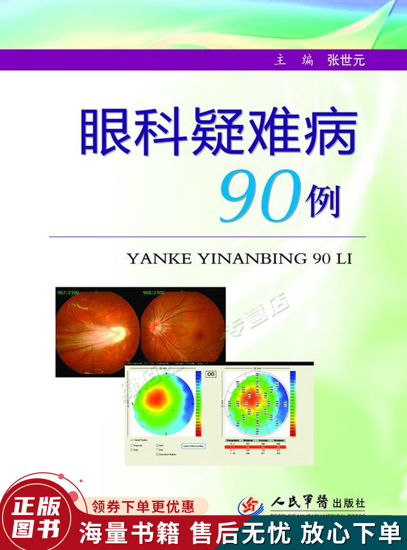 眼科疑难病90例