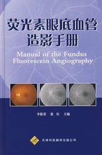 荧光素眼底血管造影手册