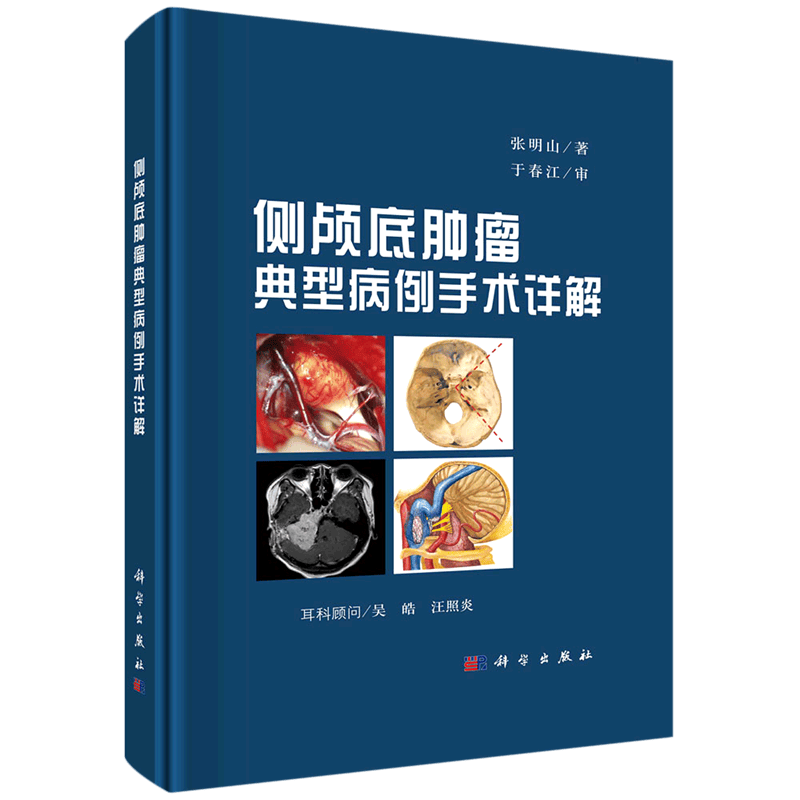侧颅底肿瘤典型病例手术详解(精)