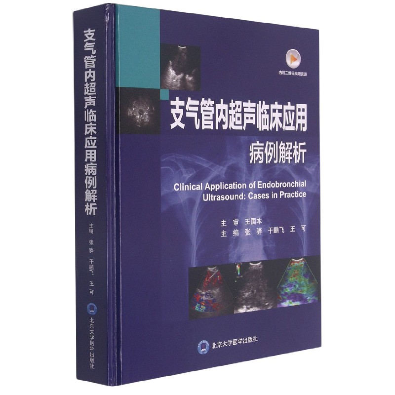 支气管内超声临床应用病例解析(精)