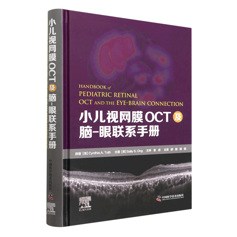 小儿视网膜OCT及脑-眼联系手册(精)