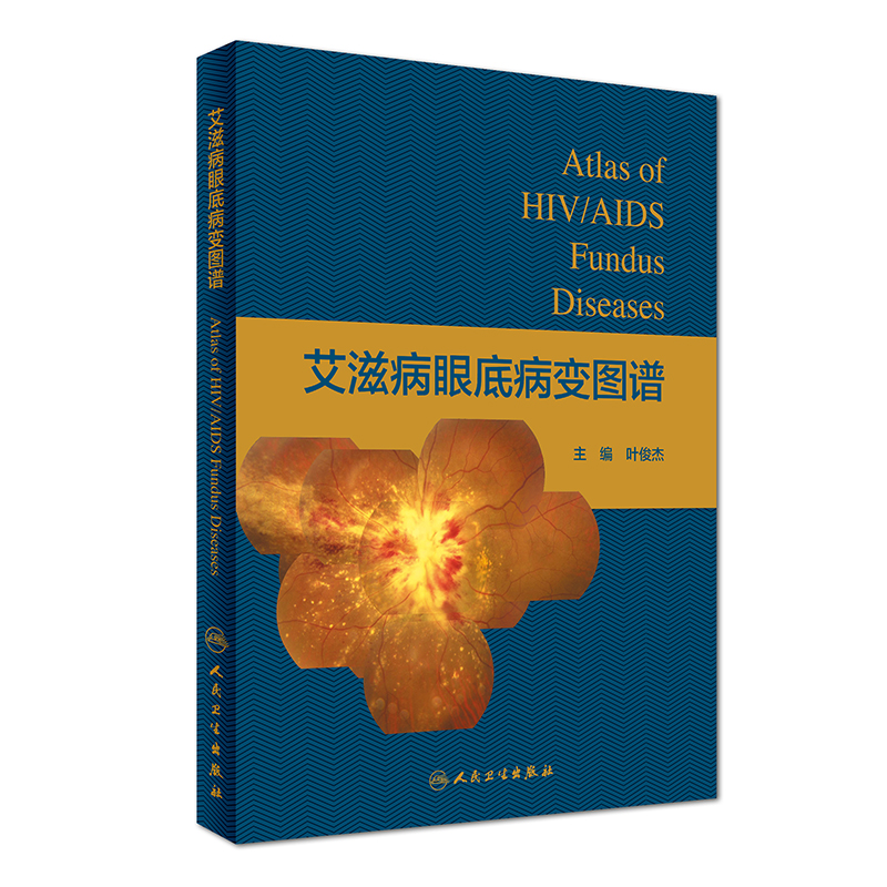 艾滋病眼底病变图谱 人卫社参考书