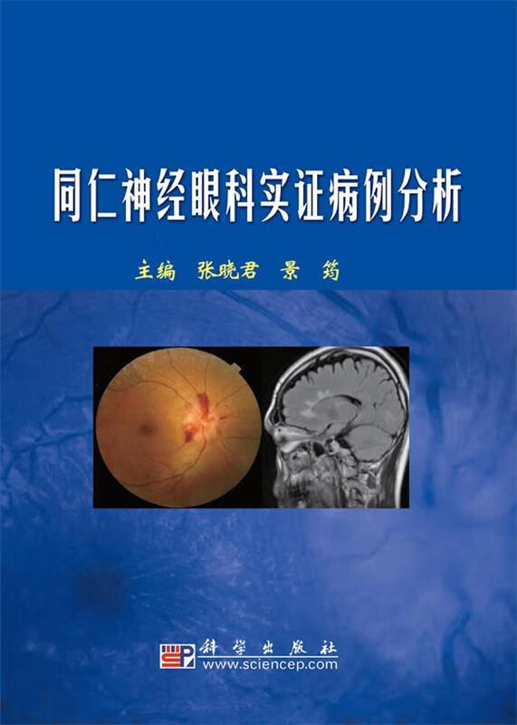 同仁神经眼科实证病例分析