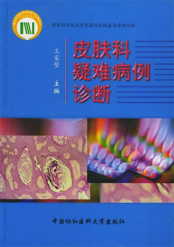 皮肤科疑难病例诊断【特惠】