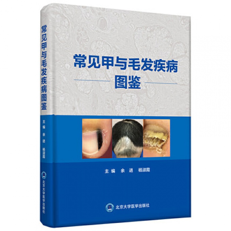 常见甲与毛发疾病图鉴 余进 杨淑霞 主编 医学书籍 皮肤镜检查 活体组织病理学检查