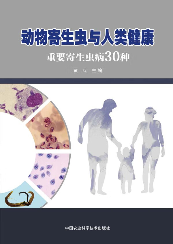 动物寄生虫与人类健康 重要寄生虫病30种