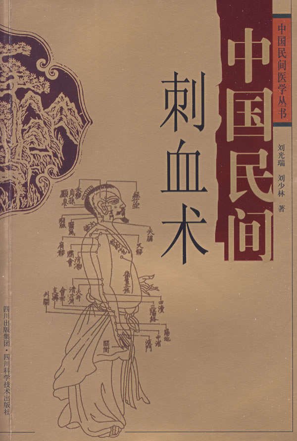 中国民间刺血术