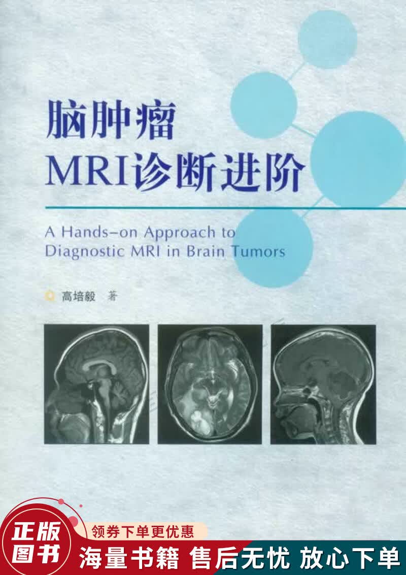 脑肿瘤MRI诊断进阶