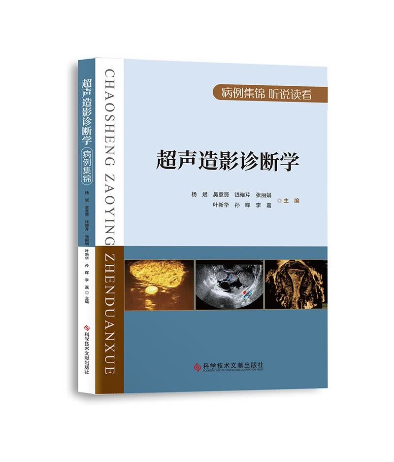超声造影诊断学