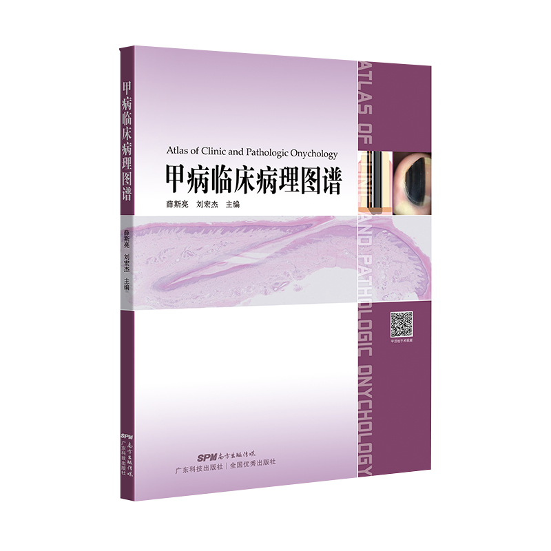 甲病诊疗图谱甲病薛斯亮刘宏杰主编甲的解剖和生理甲专业知识非肿瘤性甲病临床常见甲病广东科学技术出版社