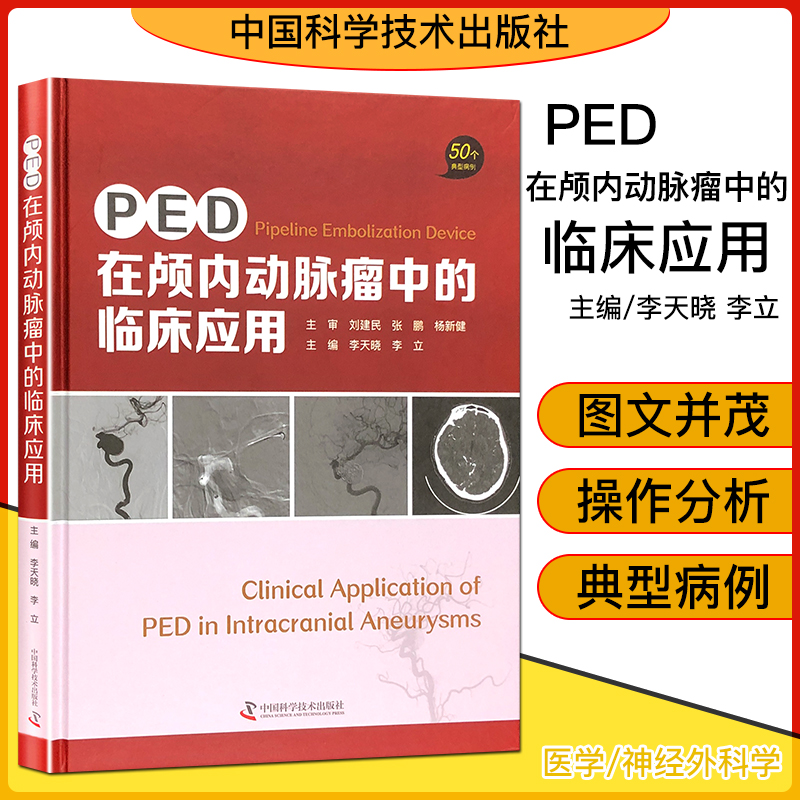 PED在颅内动脉瘤中的临床应用 50个典型病例 中国科学技术出版社