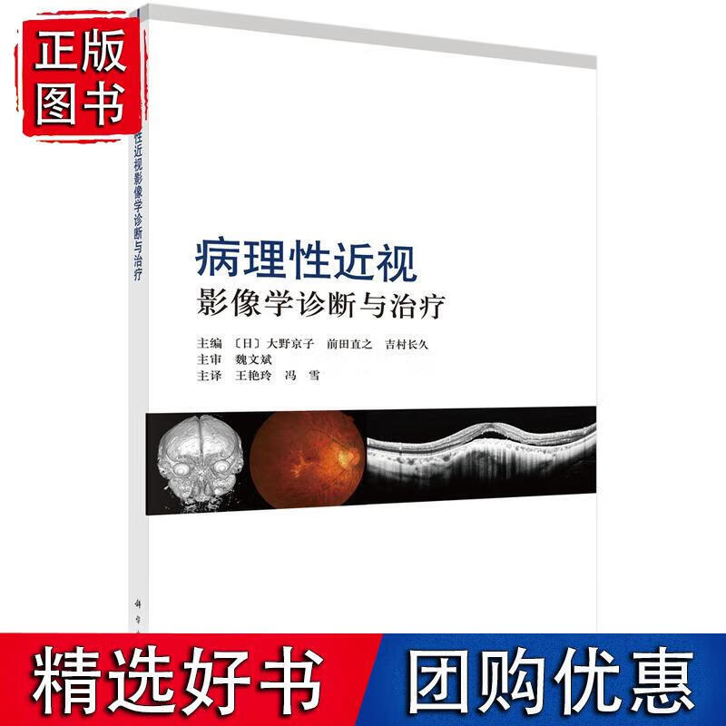 病理性近视影像学诊断与治疗 科学出版社