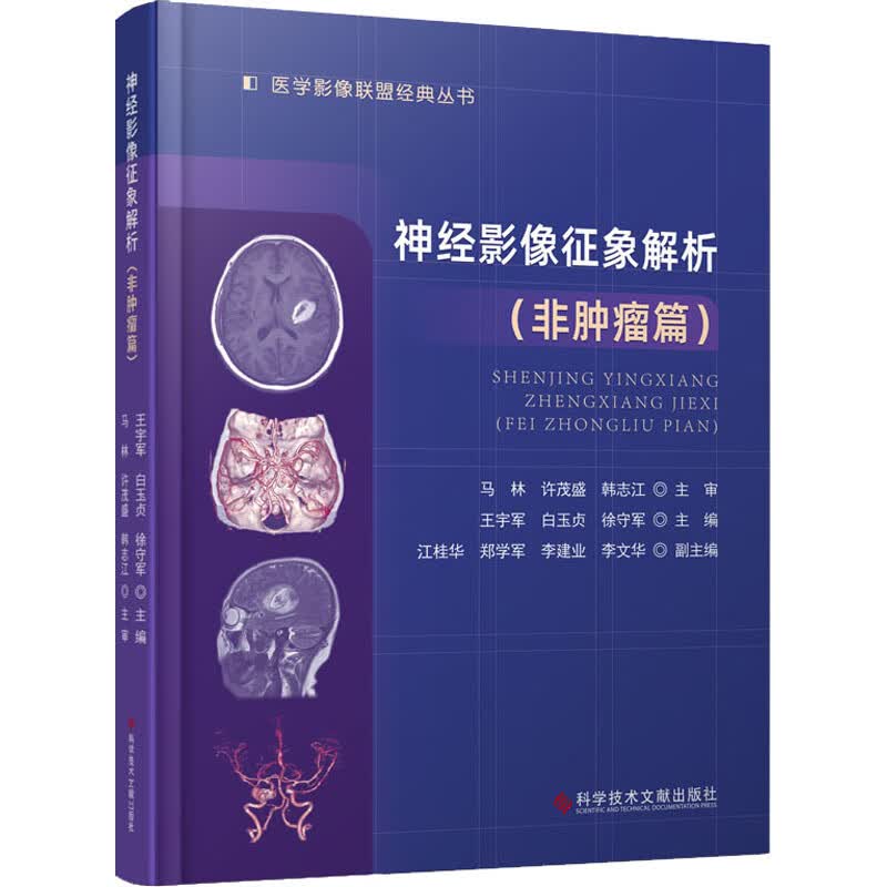 神经影像征象解析