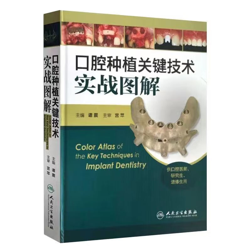 口腔种植关键实战图解