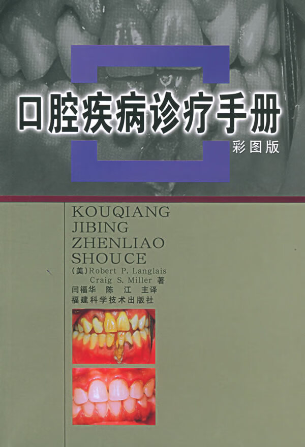 口腔疾病诊疗手册