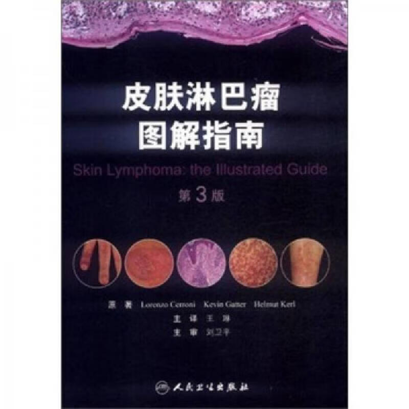 皮肤淋巴瘤图解指南 [美]赛罗琳 人民卫生出版社 9787117153232