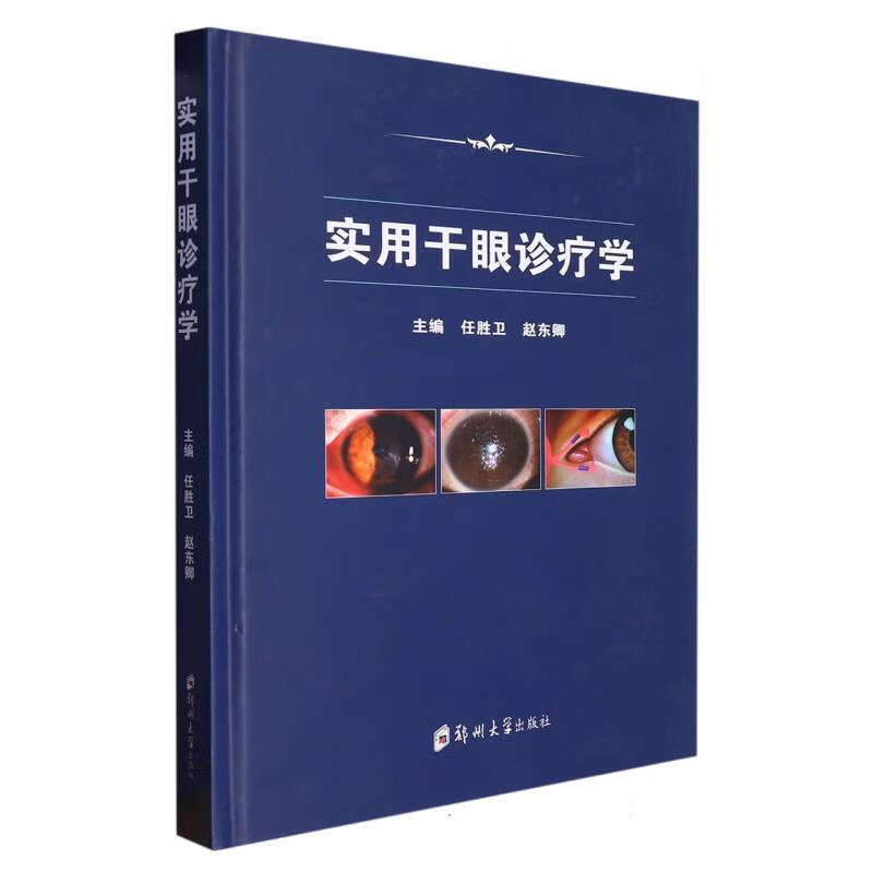 实用干眼诊疗学(精)