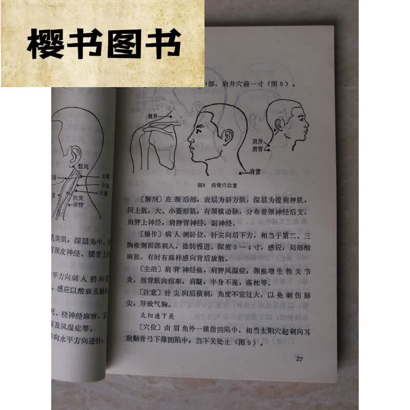 芒针疗法（杨兆钢编，1980年老版本中医旧）