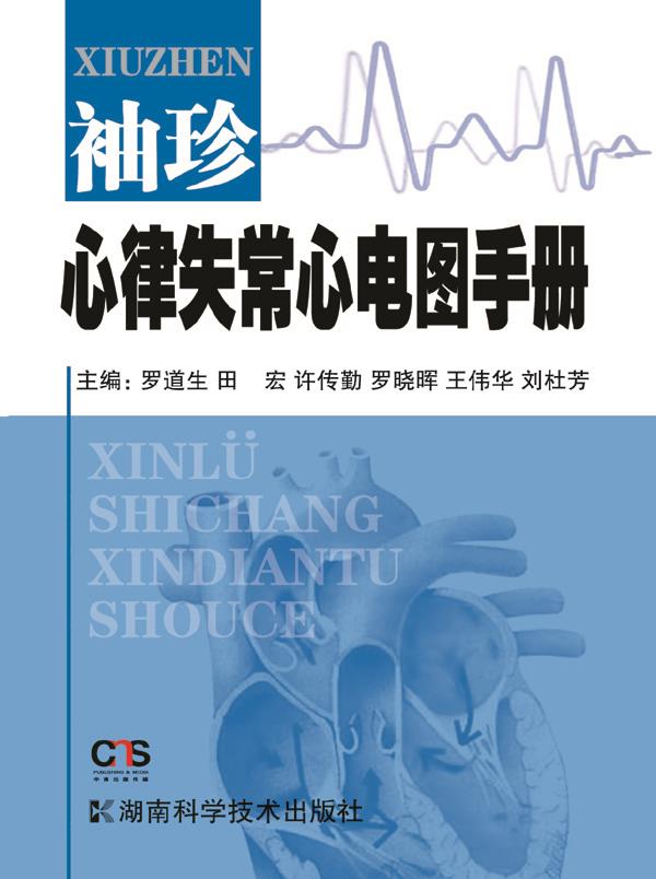 袖珍心律失常心电图手册