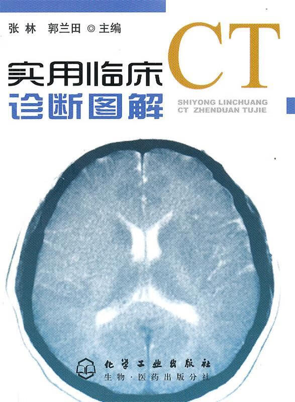 实用临床CT诊断图解