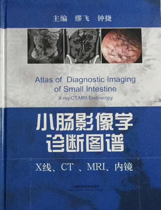 小肠影像学诊断图谱 缪飞, 钟捷【书】