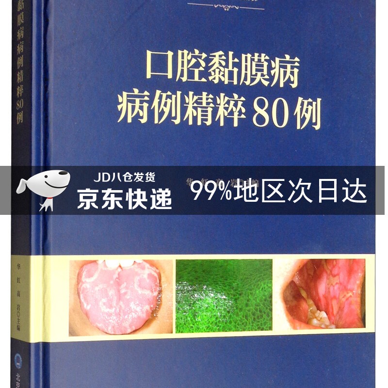 口腔黏膜疑难病例精粹80例
