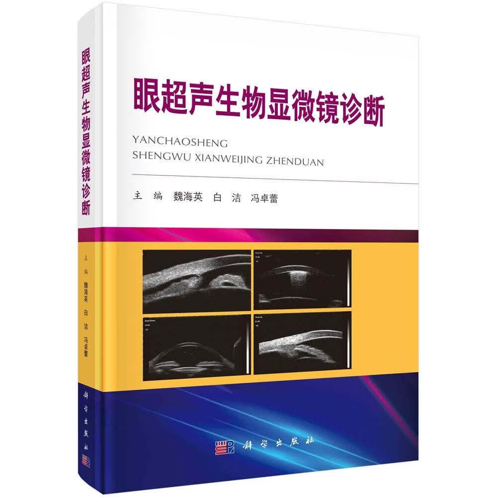 眼超声诊断