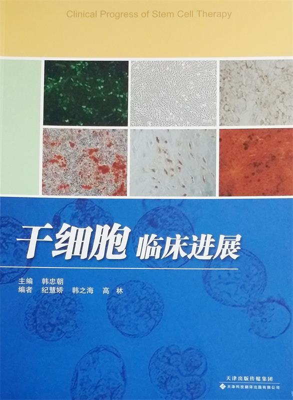 干细胞临床进展