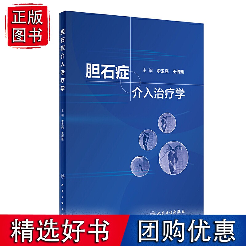 胆石症介入治疗学