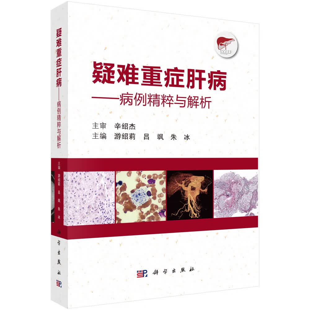 疑难重症肝病——病例精粹与解析