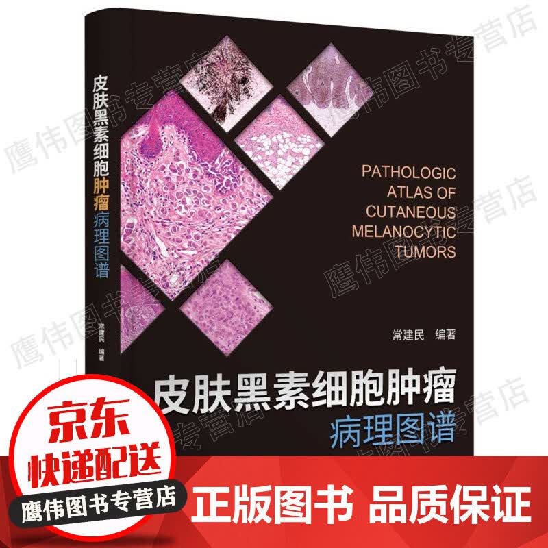 皮肤黑素细胞肿瘤病理图谱