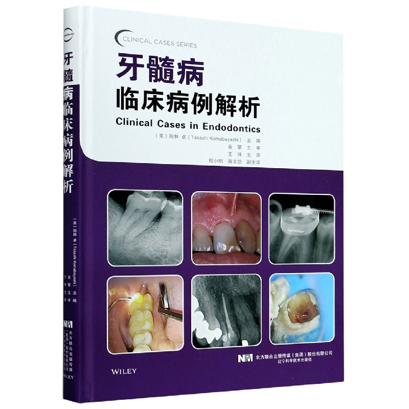 牙髓病临床病例解析(精)