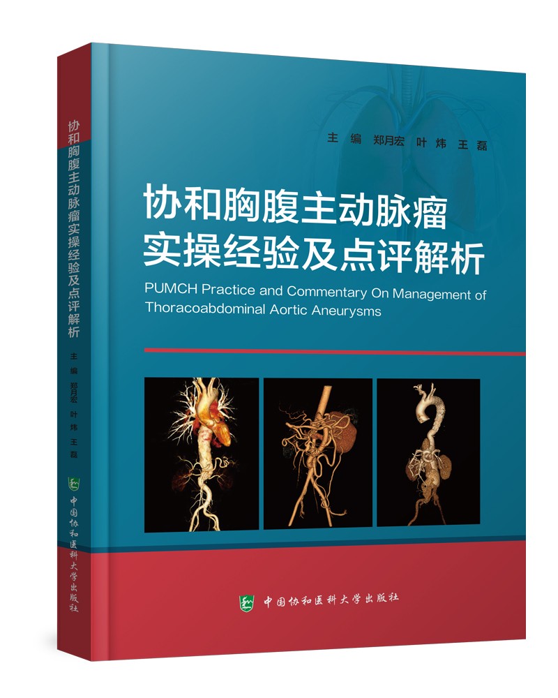 协和胸腹主动脉瘤实操经验及点评解析