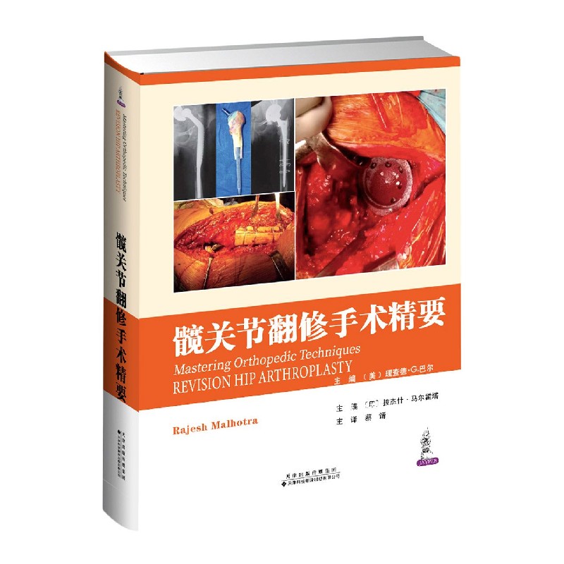 髋关节翻修手术精要(精)