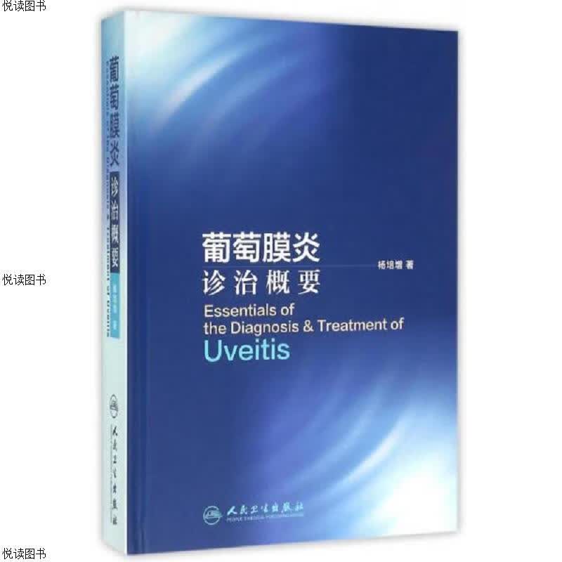 葡萄膜炎诊治概要