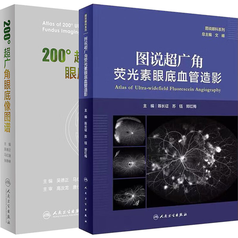 图说超广角荧光素眼底血管造影+200°超广角眼底像图谱 人民卫生出版社