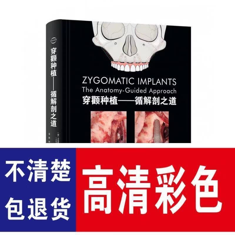 穿颧种植--循解剖之道 现货超清