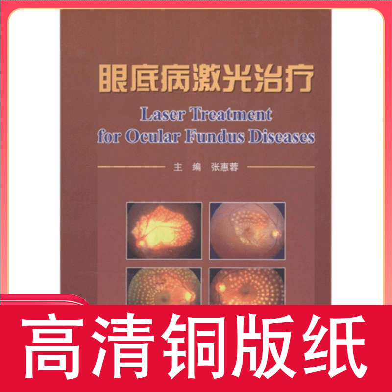 眼底病激光治疗 张惠蓉眼第9版 铜版纸