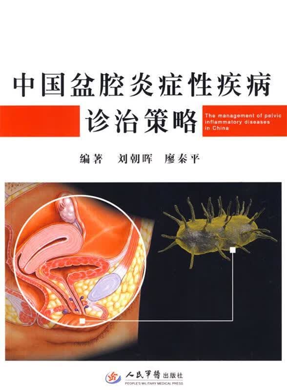 中国盆腔炎症性疾病诊治策略
