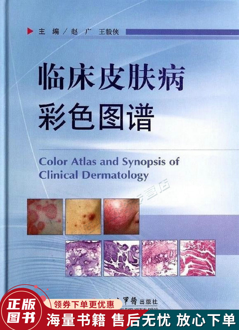 临床皮肤病彩色图谱