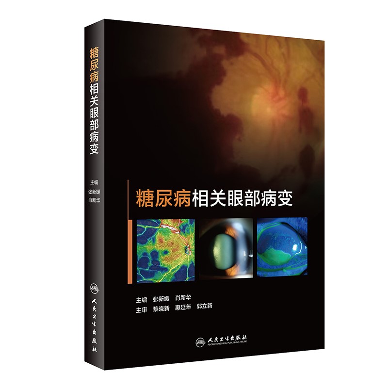 【现货速发】糖尿病相关眼部病变