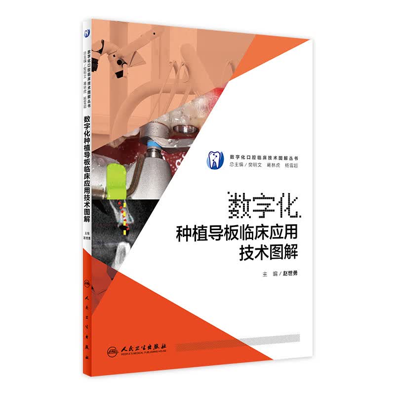 数字化种植导板临床应用技术图解