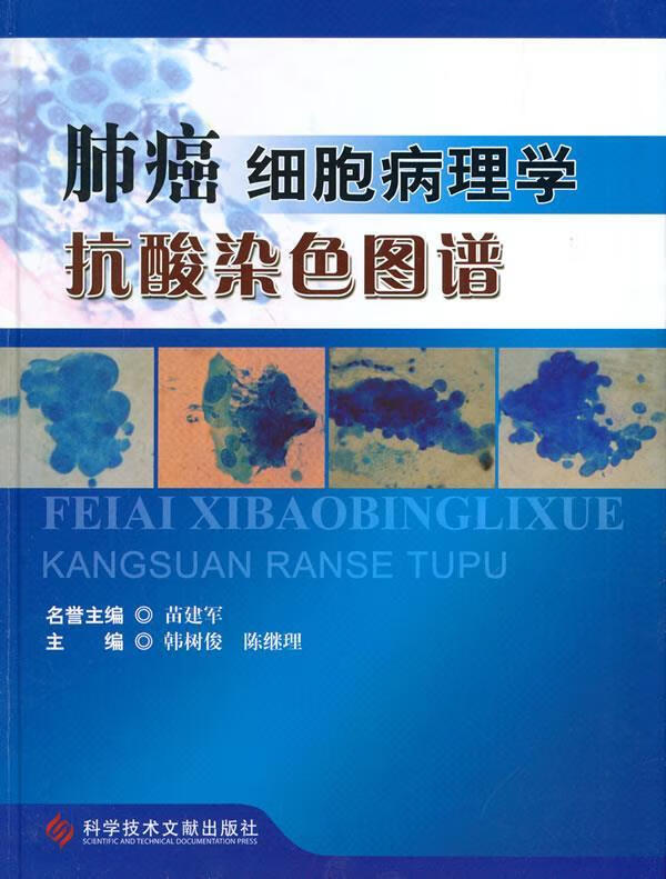 肺癌细胞病理学抗酸染色图谱【，放心购买】