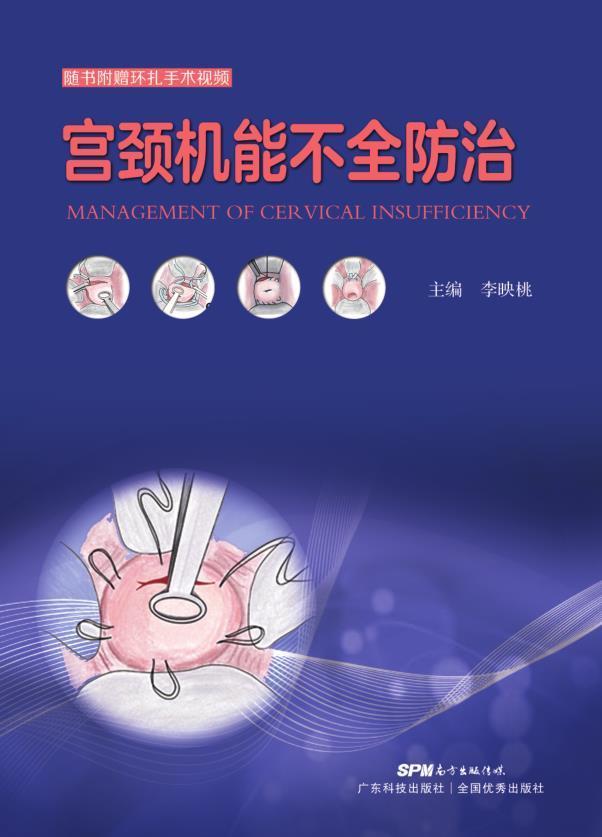 宫颈机能不全李映桃广东科技出版社有限公司9787535972194 医学书籍