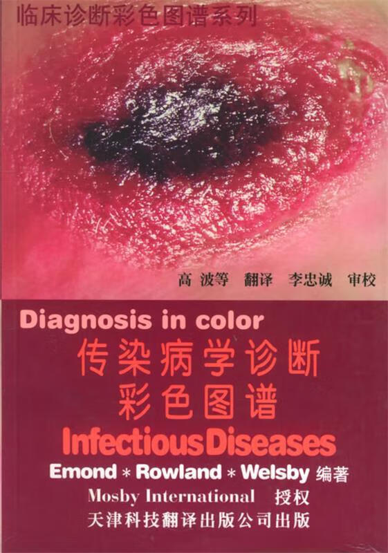 传染病学诊断彩色图谱 (英)埃蒙得(Emond,R.T.D.) 等编著,高波 等译