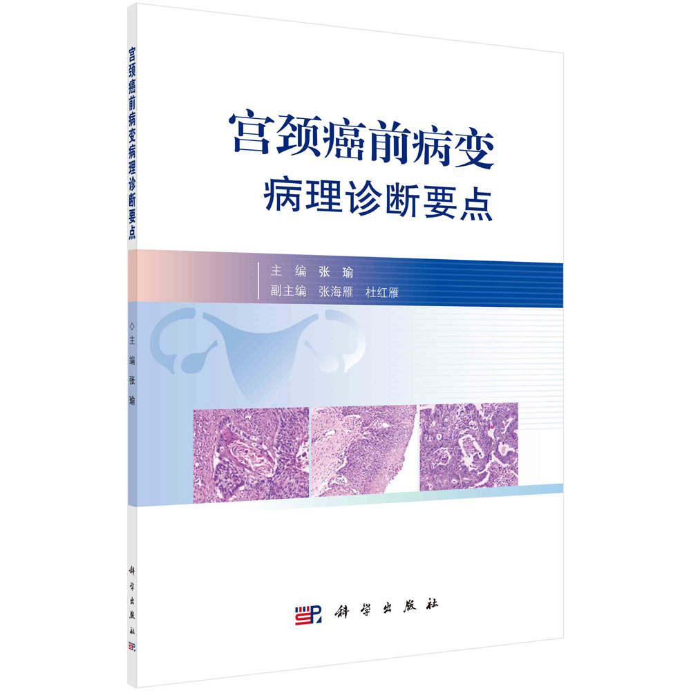 宫颈癌前病变病理诊断要点/张瑜