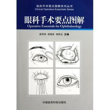 眼科手术要点图解【好书，下单速发】