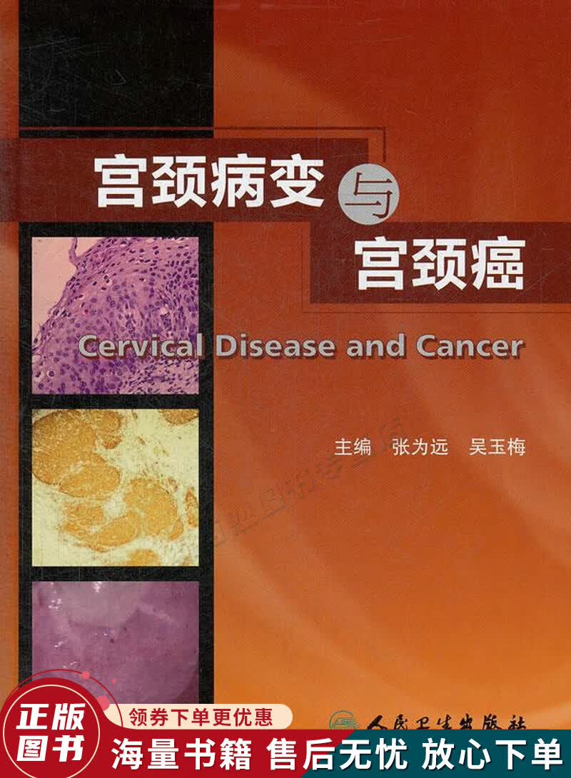 宫颈病变与宫颈癌