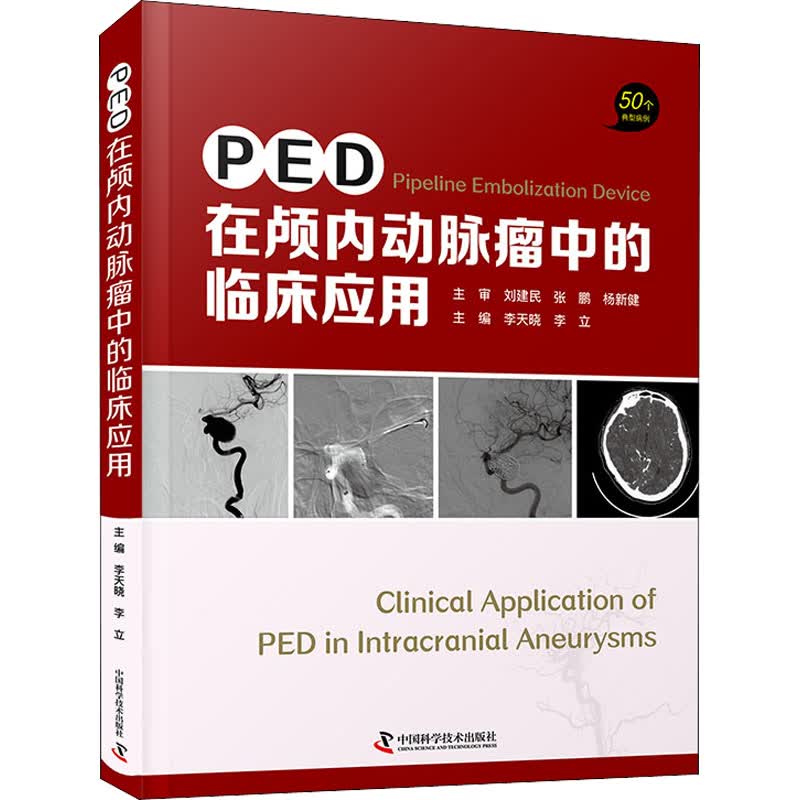 PED在颅内动脉瘤中的临床应用 李天晓,李立 编 妇产科